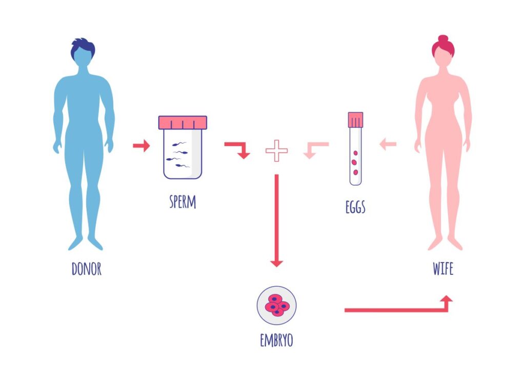 Donor/IVF